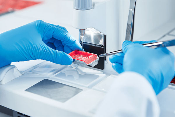 Paraffin Tissue Processing：Steps and Precautions - Nanjing Superfit I&E ...